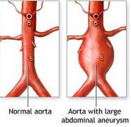 AAA Pain in the Back! - Dock Line Magazine